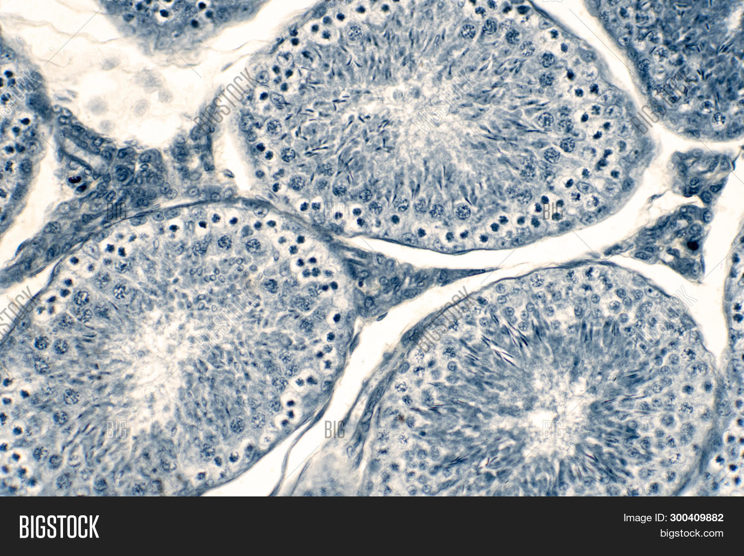 Cross Section Human Testis Under Microscope View. Shows Spermatogonia ...