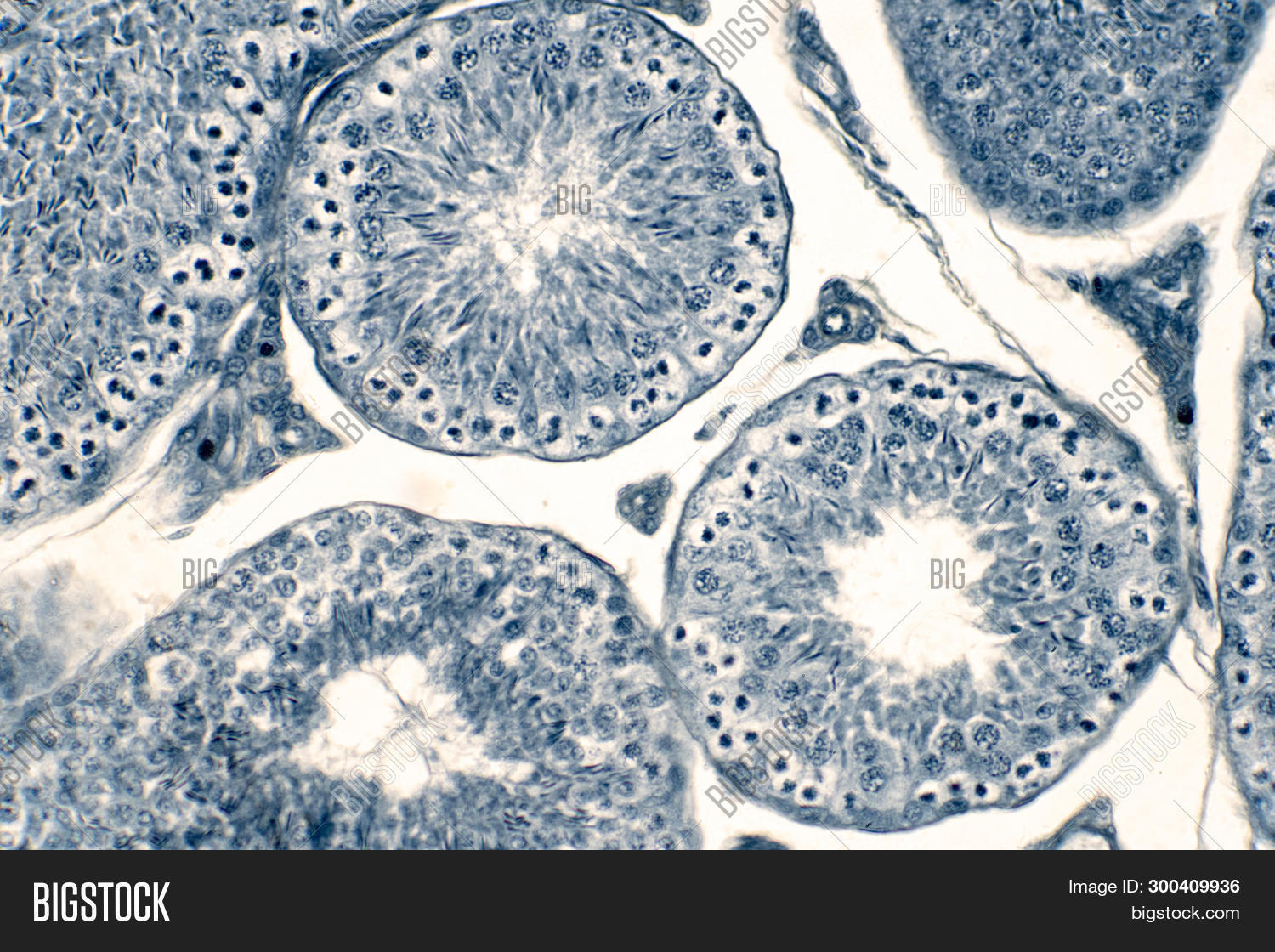 Cross Section Human Testis Under Microscope View Shows Spermatogonia
