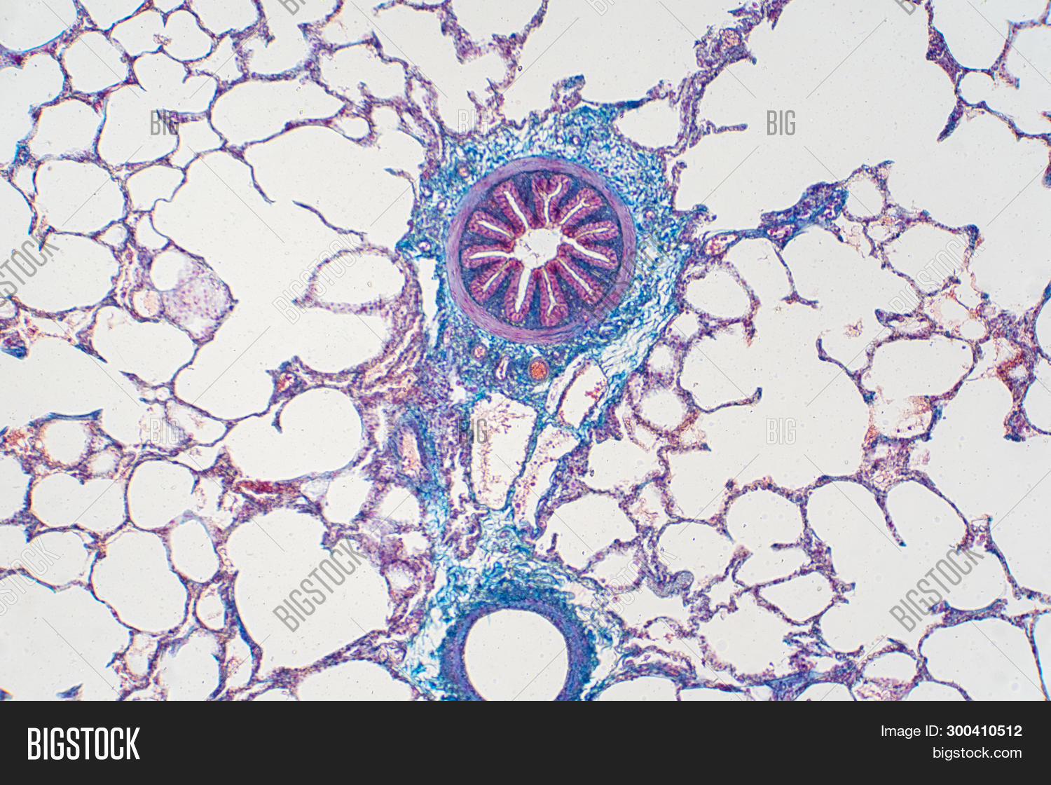 Human Lung Tissue Under Microscope View. Lungs Are The Primary Organs ...