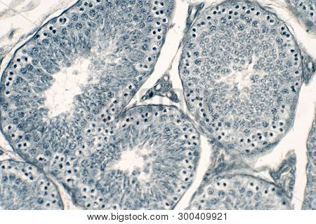 Cross Section Human Testis Under Microscope View. Shows Spermatogonia ...