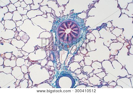 Human Lung Tissue Under Microscope View. Lungs Are The Primary Organs ...