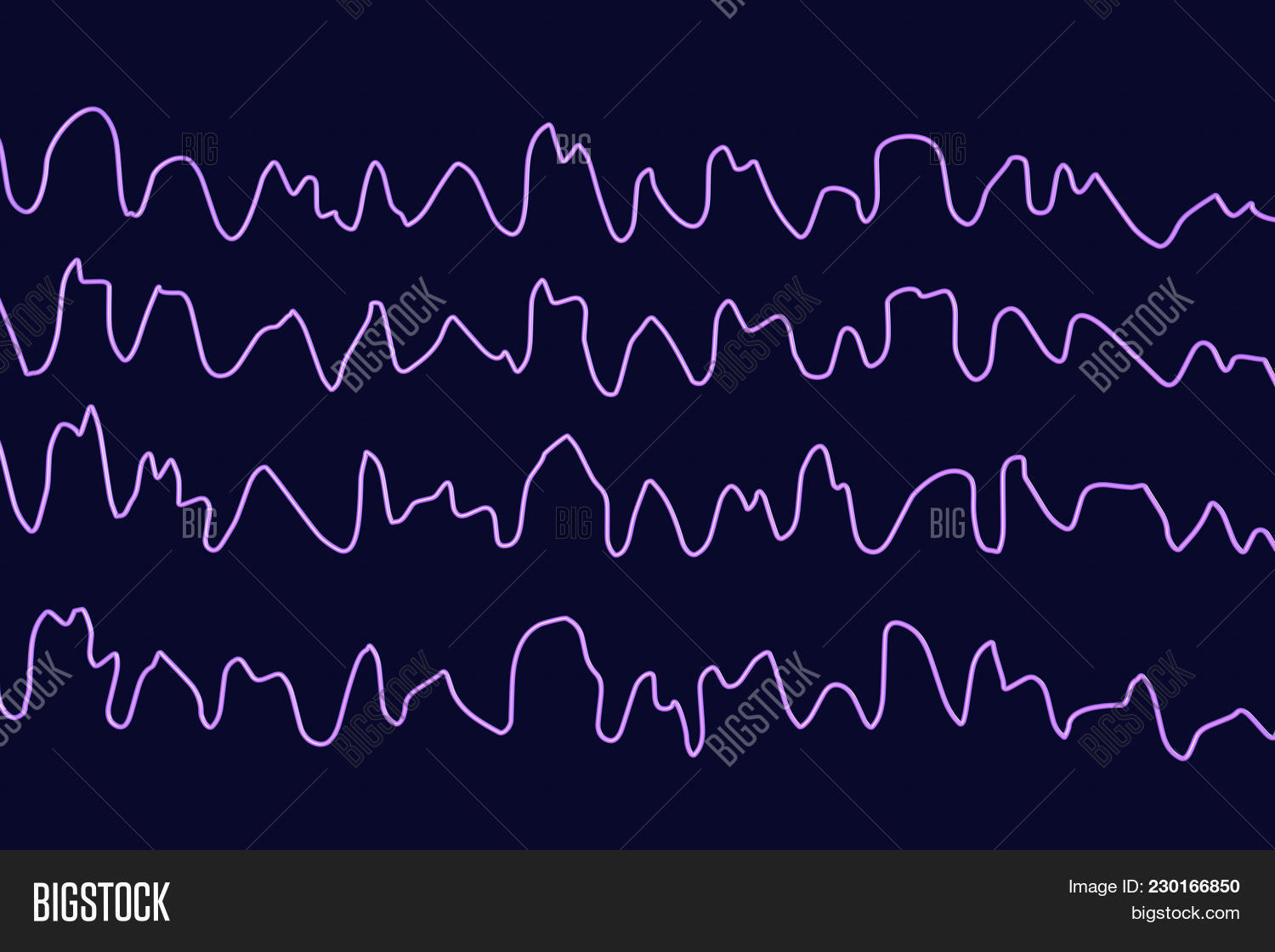 Eeg Electroencephalogram, Brain Wave During Sleeping, 3d Illustration ...