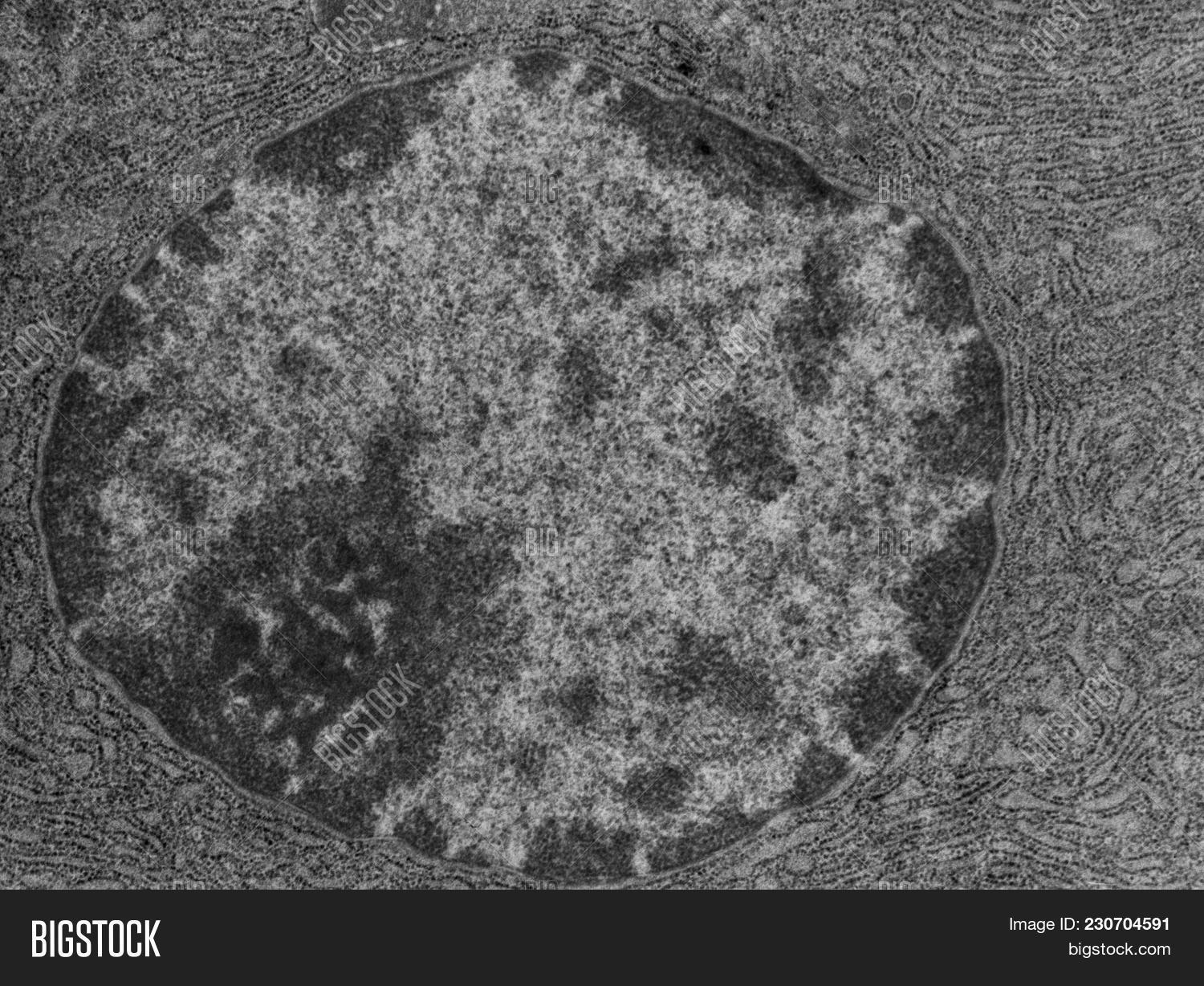 Transmission Electron Microscope (tem) Showing The Nucleus Of A Protein ...