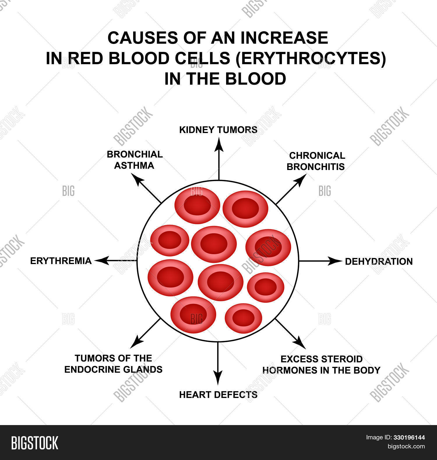 Causes Of Increased Red Blood Cells. Cells Erythrocytes. Hemoglobin ...