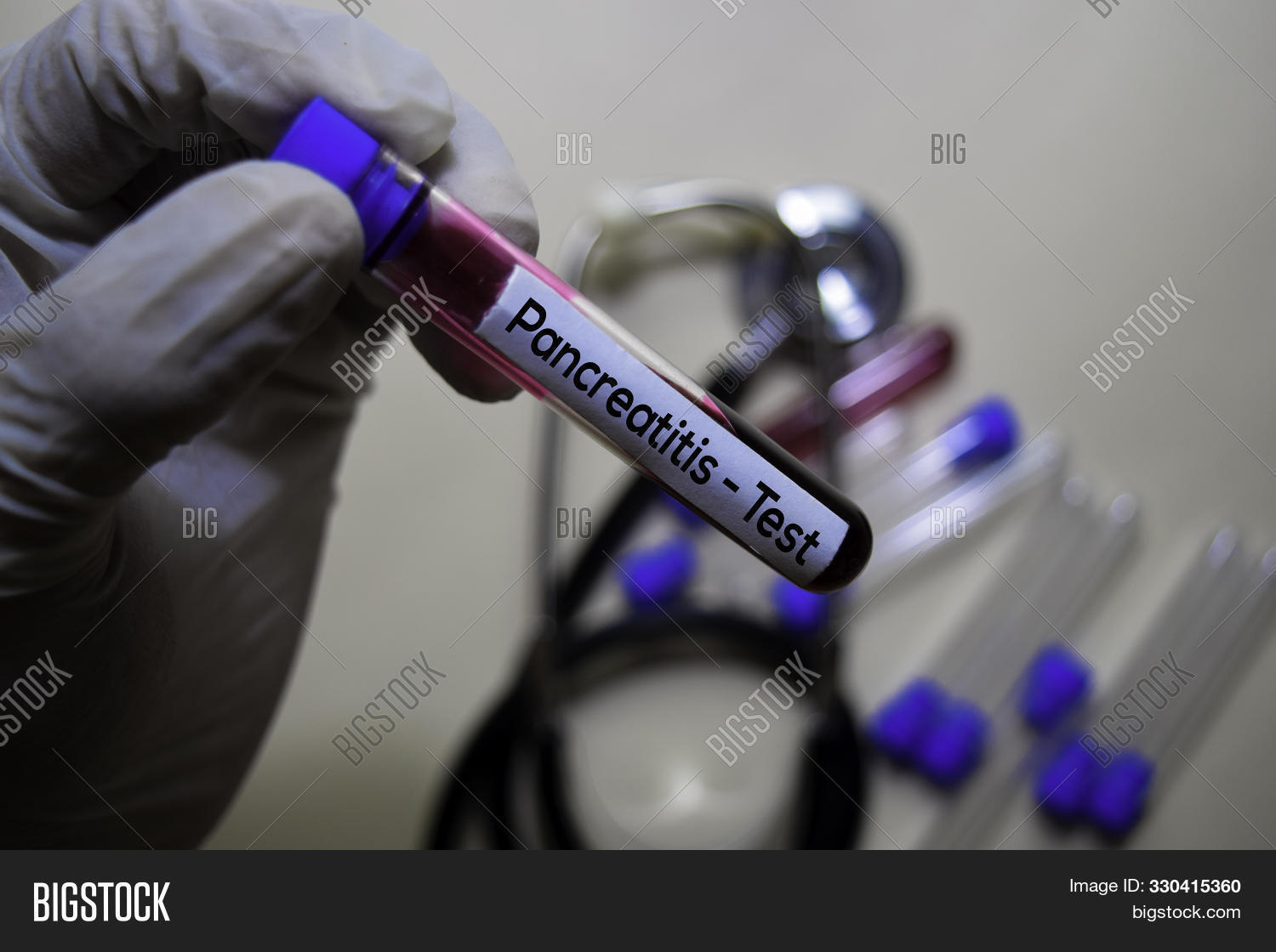 Pancreatitis - Test With Blood Sample. Top View Isolated On Office Desk ...