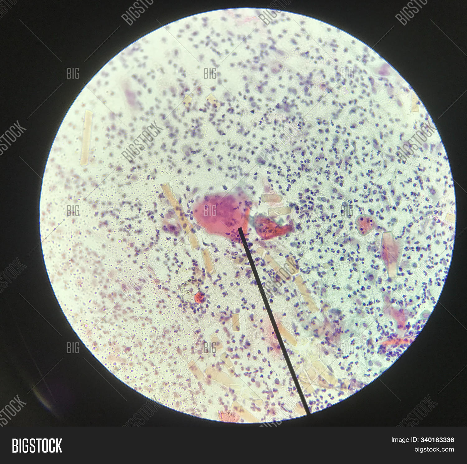 Cells In Reproductive Female Cytology And Histology Concept. image ...