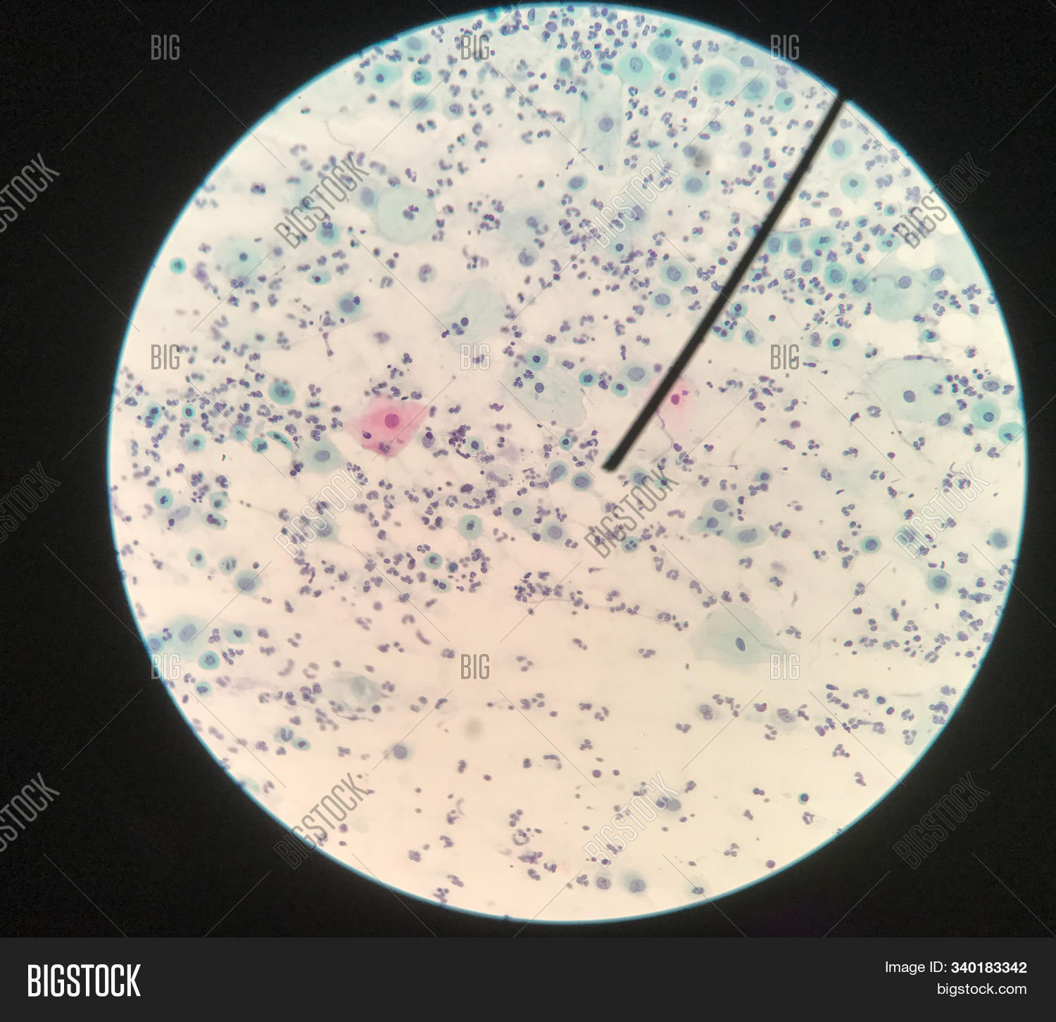 Cells In Reproductive Female Cytology And Histology Concept. image ...