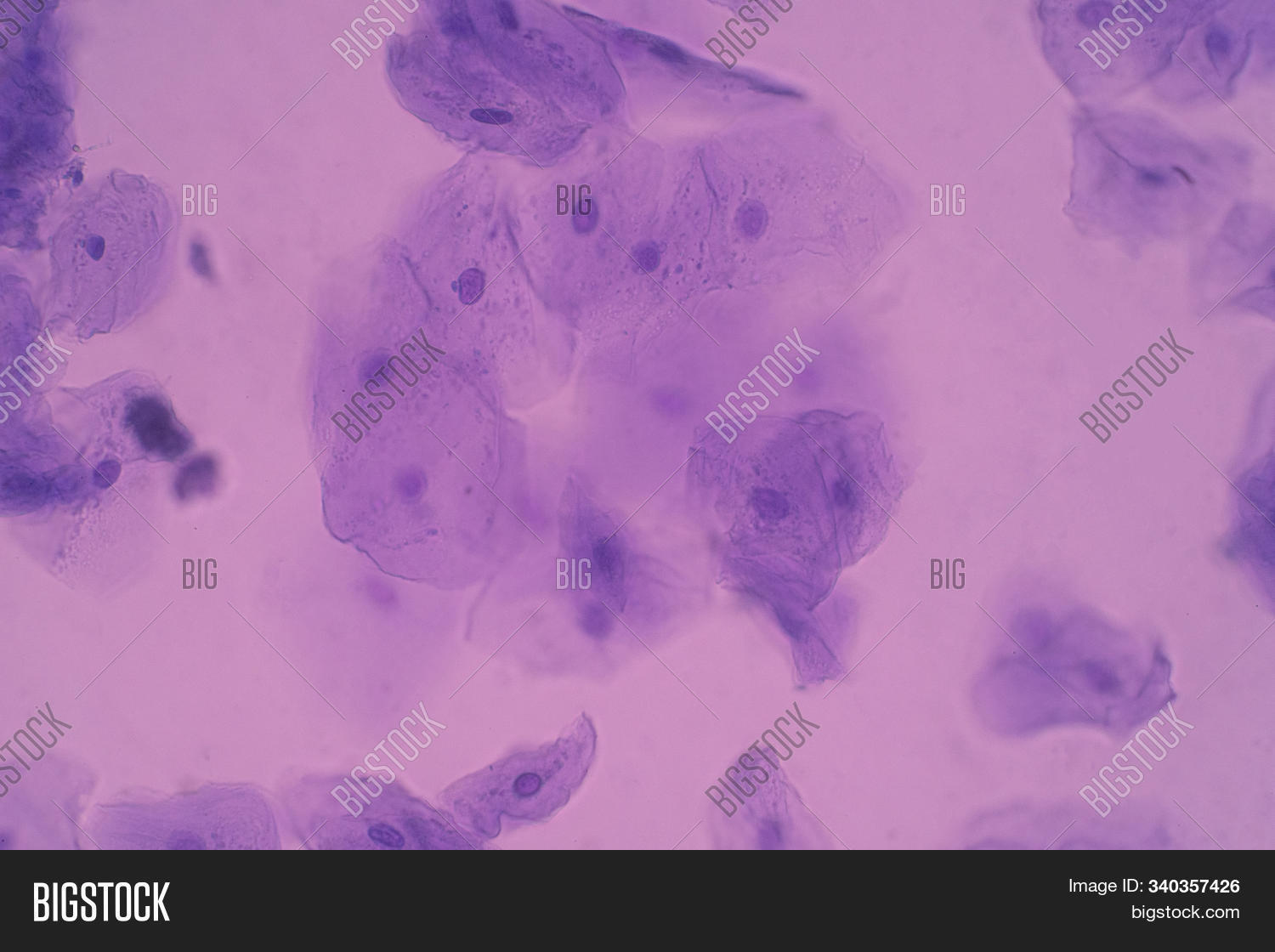 Human Cheek Epithelial Cells. The Tissue That Lines The Inside Of The ...