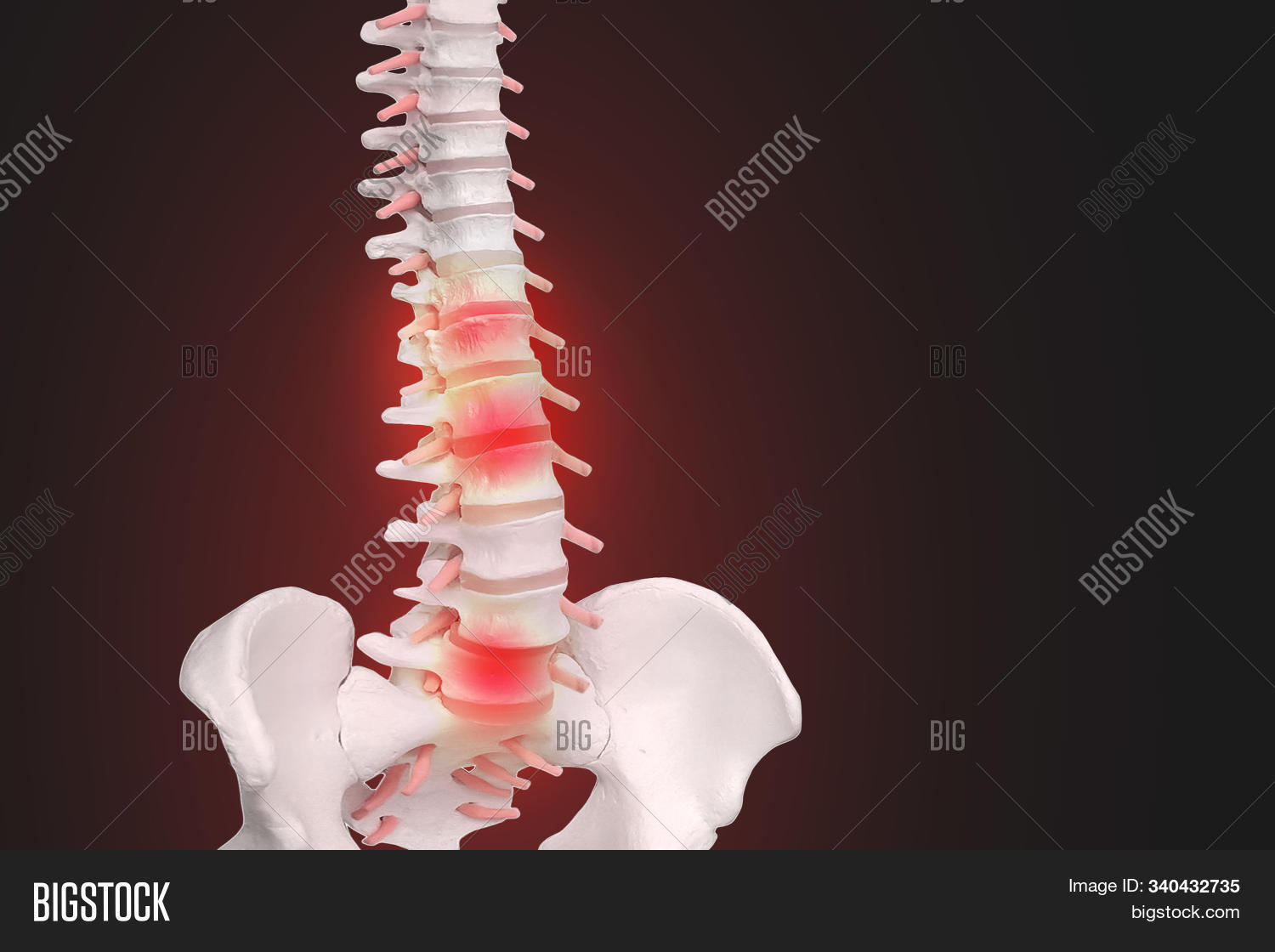 Realistic Skeletal Human Spine And Vertebral Column Or Intervertebral ...