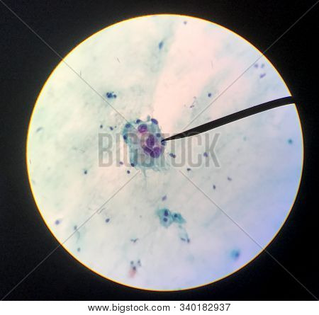Cells In Reproductive Female Cytology And Histology Concept. image ...