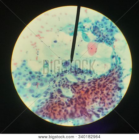 Cells In Reproductive Female Cytology And Histology Concept. image ...