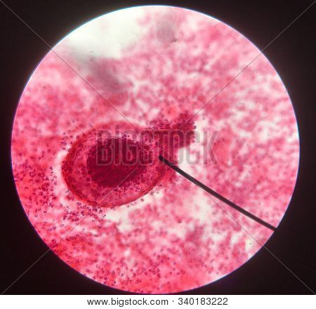 Cells In Reproductive Female Cytology And Histology Concept. image ...