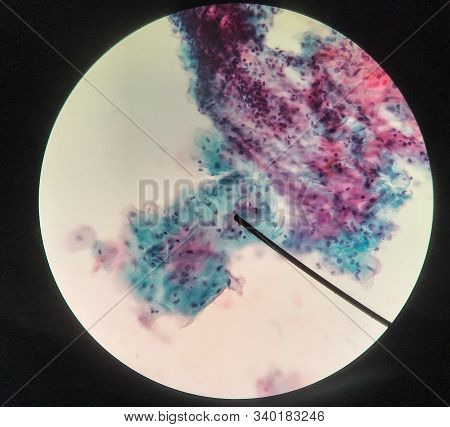 Cells In Reproductive Female Cytology And Histology Concept. image ...