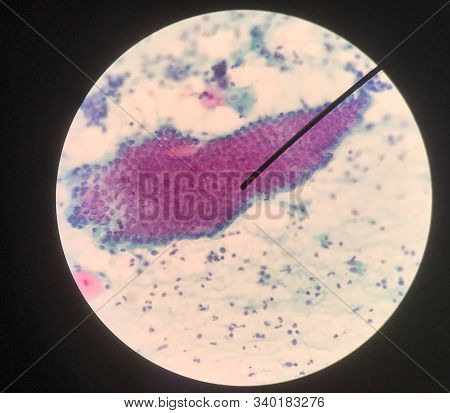 Cells In Reproductive Female Cytology And Histology Concept. image ...