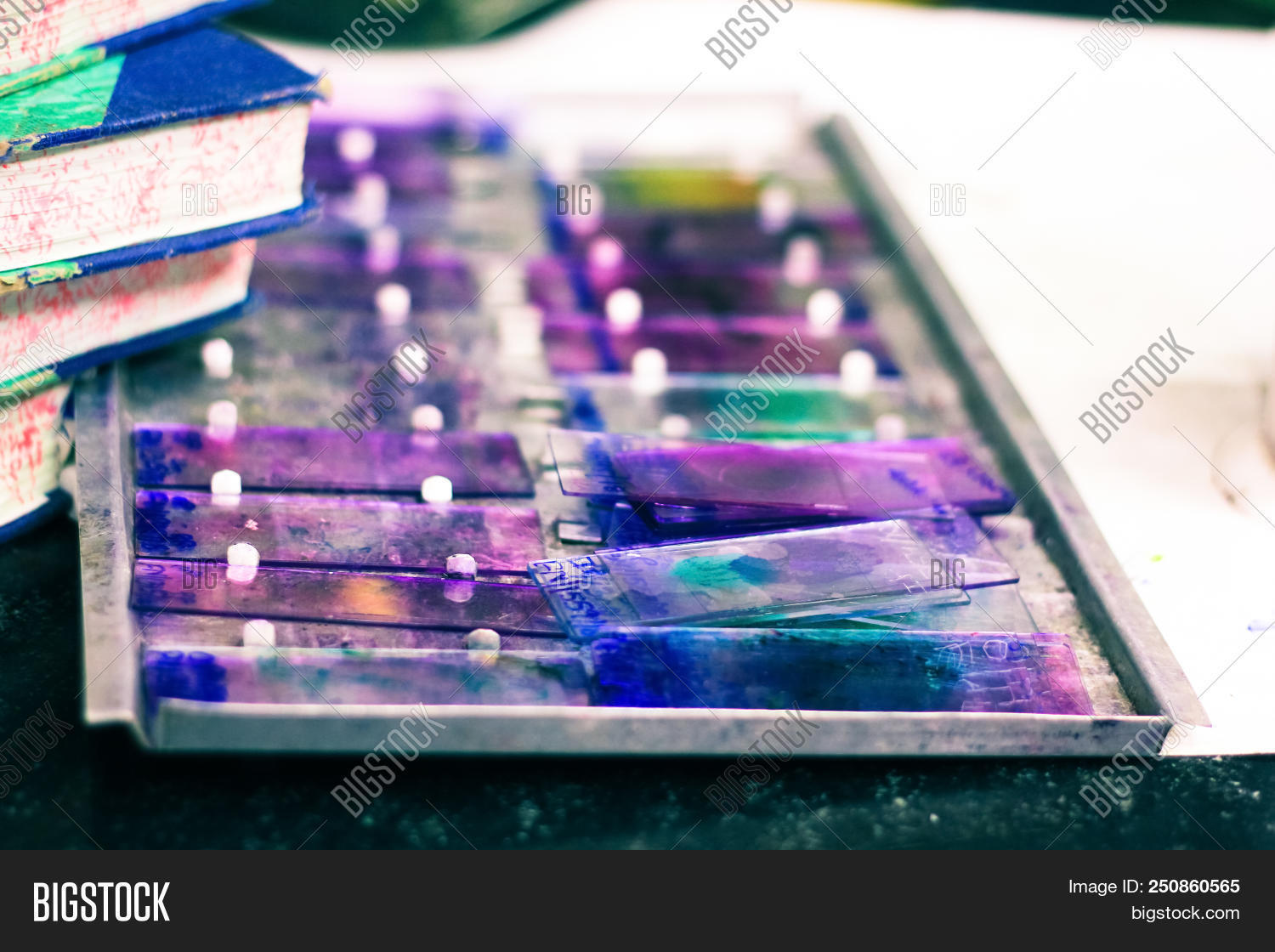 Stained Glass Slides Of Peripheral Blood Smear With Violet Leishman ...