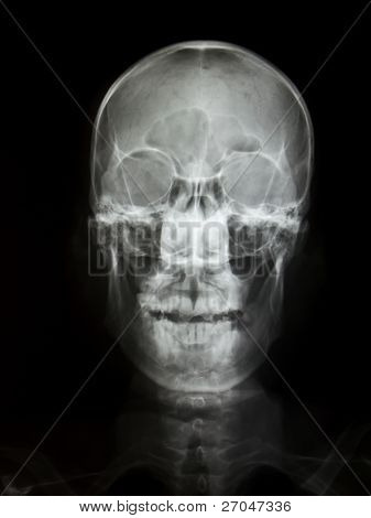 Front face skull x-ray image image & stock photo. 27047336