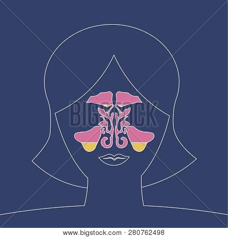 Sinusitis Disease, Vector Nose Illustration, Sinus Anatomy, Human ...