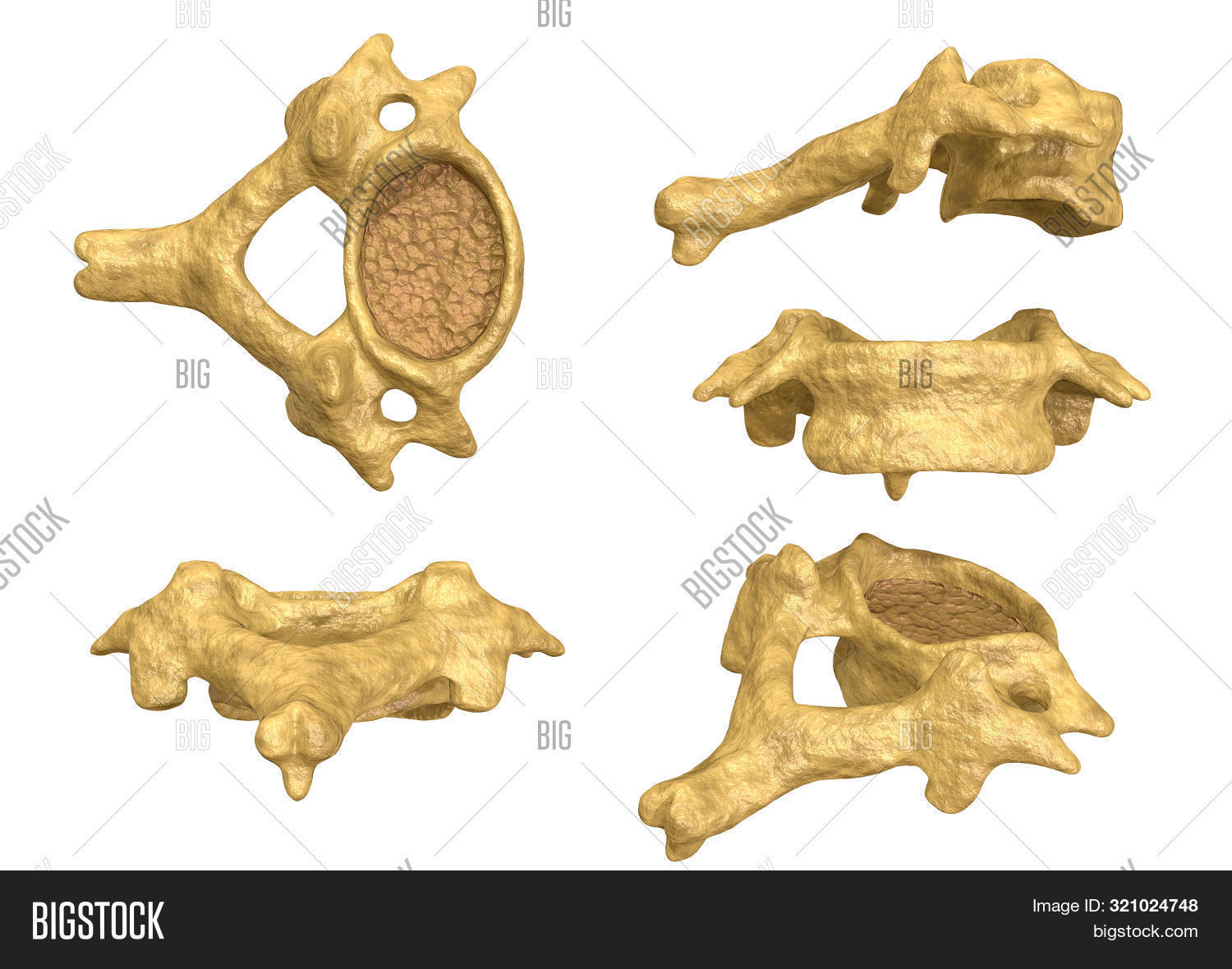 Morphology Of The Cervical Vertebra, Sixth Cervical Vertebra, Multiple ...