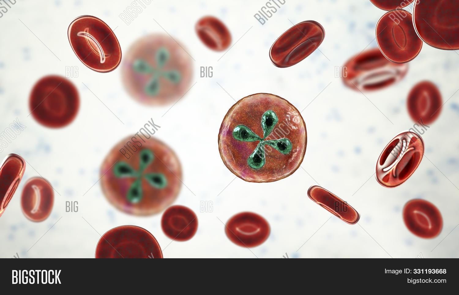 Babesia Parasites Inside Red Blood Cell, The Causative Agent Of ...