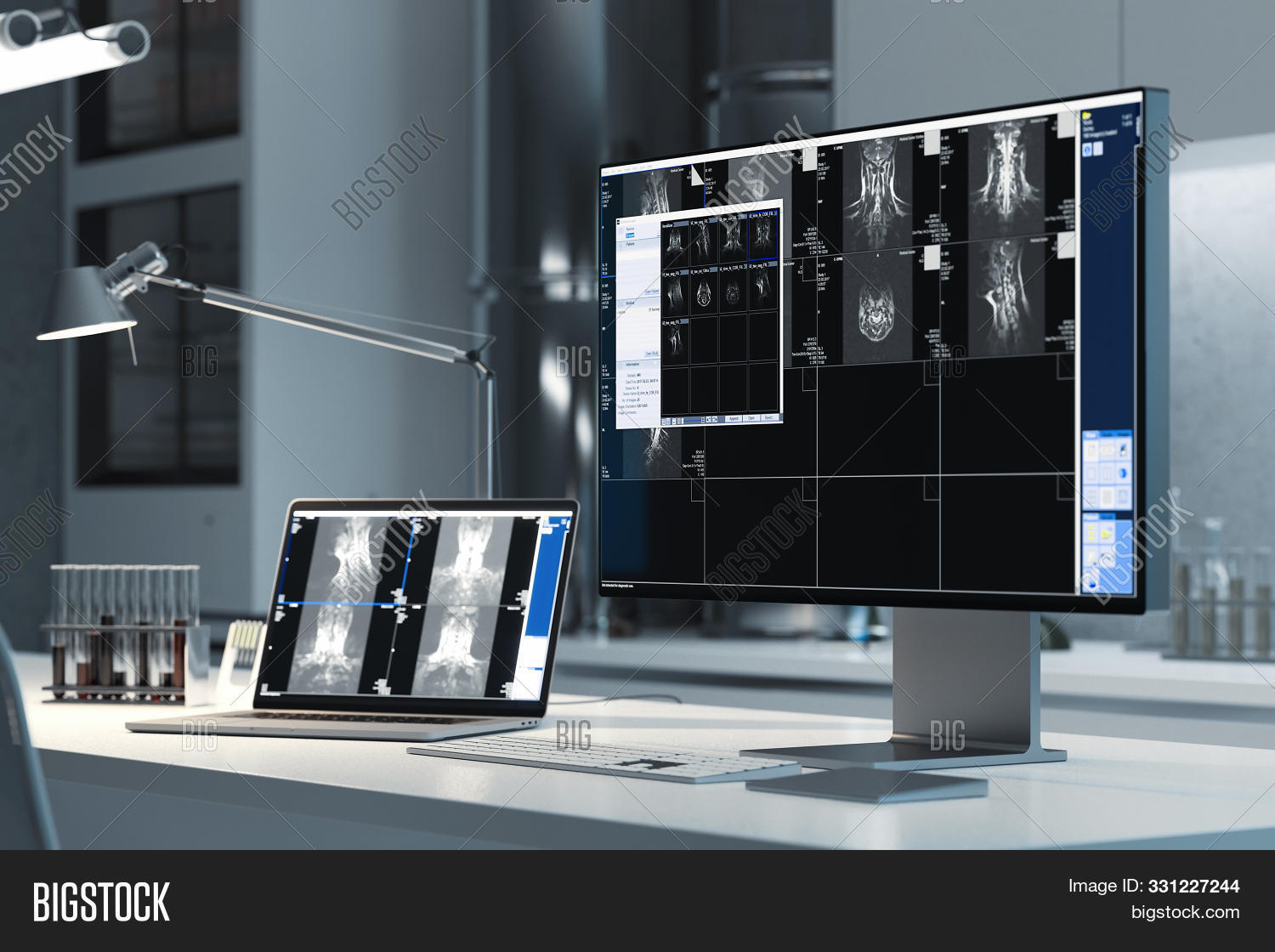 Modern Pc With Magnetic Resonance Tomography Results Of Patient On ...