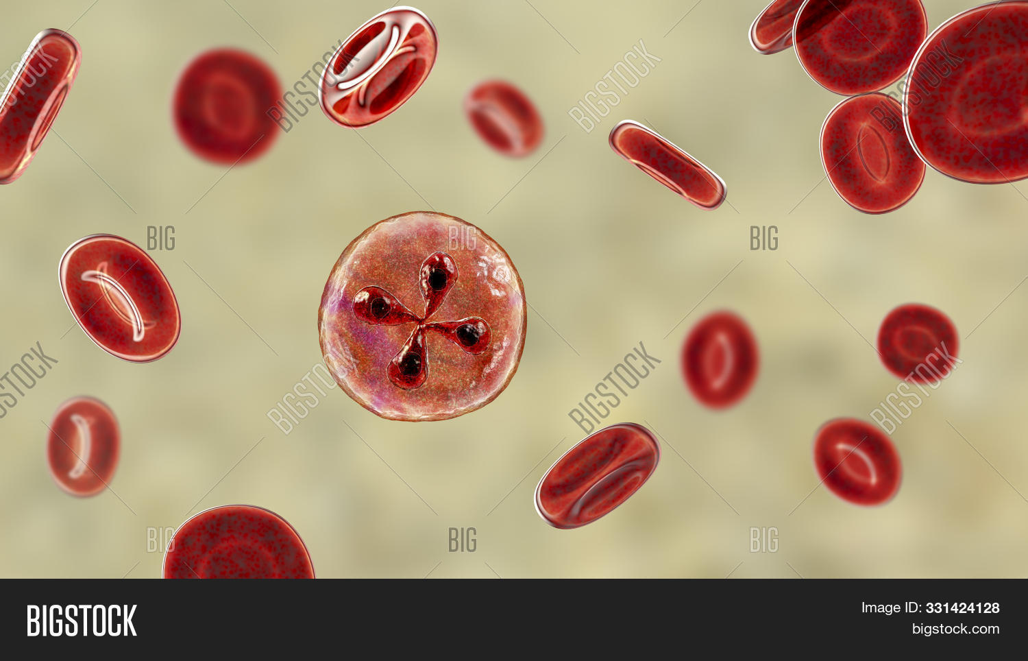 Babesia Parasites Inside Red Blood Cell, The Causative Agent Of ...