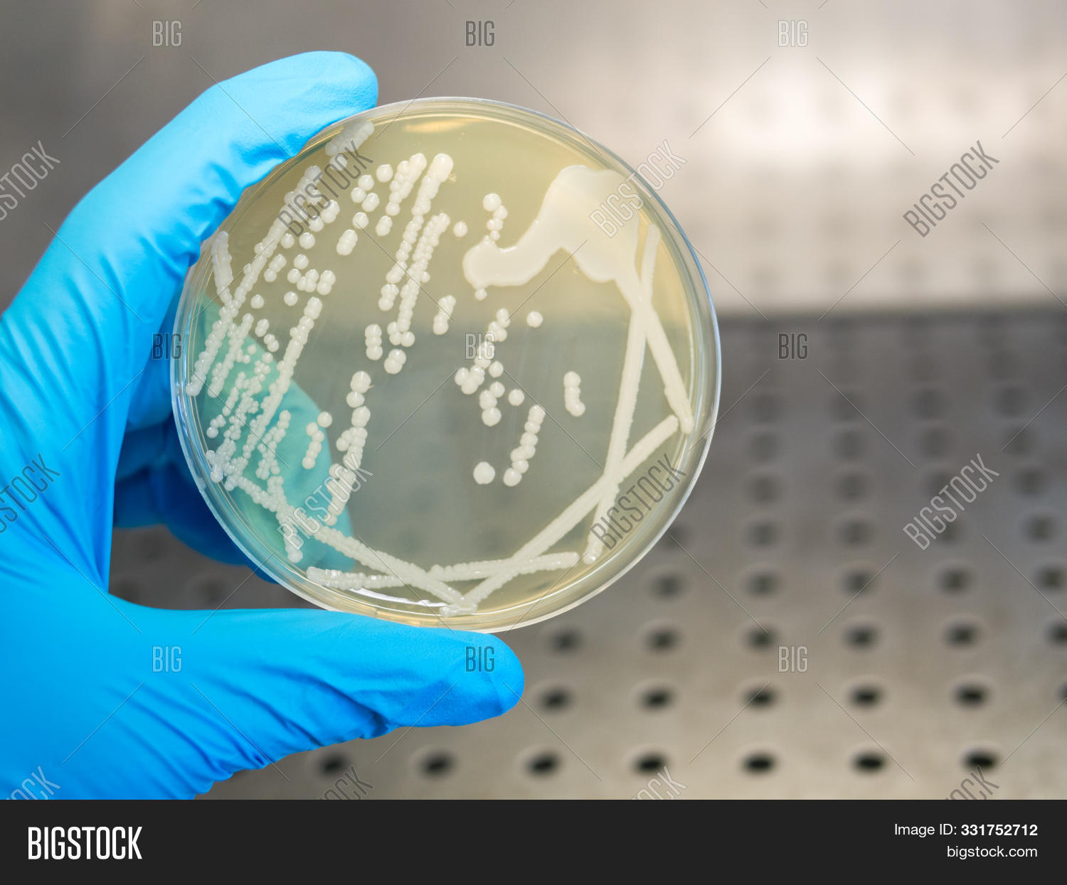 Hand Holding A Petri Dish With Isolated Bacteria Colonies In A Laminar ...