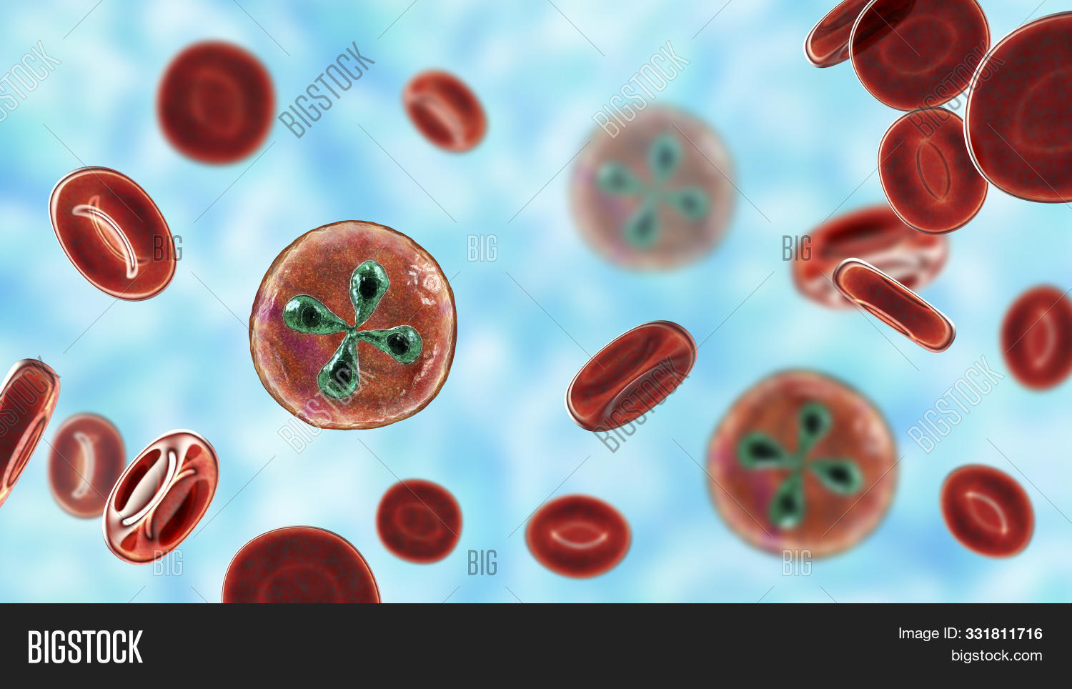 Babesia Parasites Inside Red Blood Cell, The Causative Agent Of ...