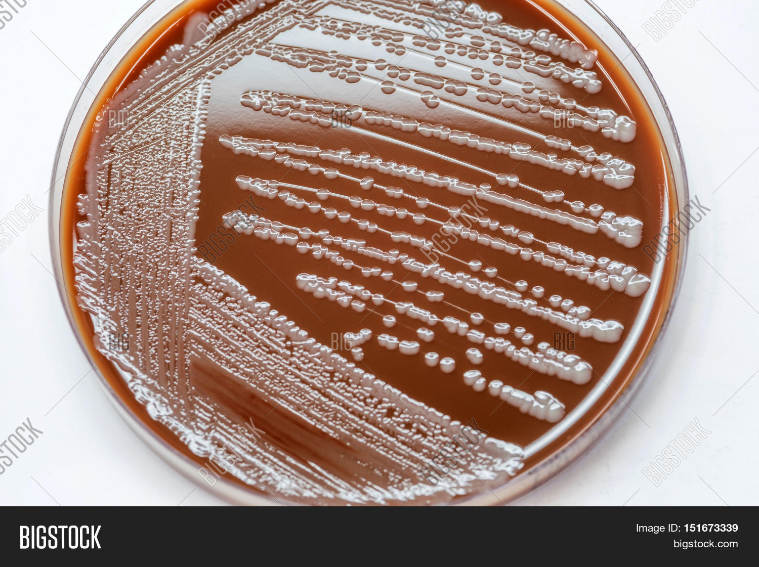 Staphylococcus Spp; Bacterial Colonies Culture On Chocolate Agar. image ...