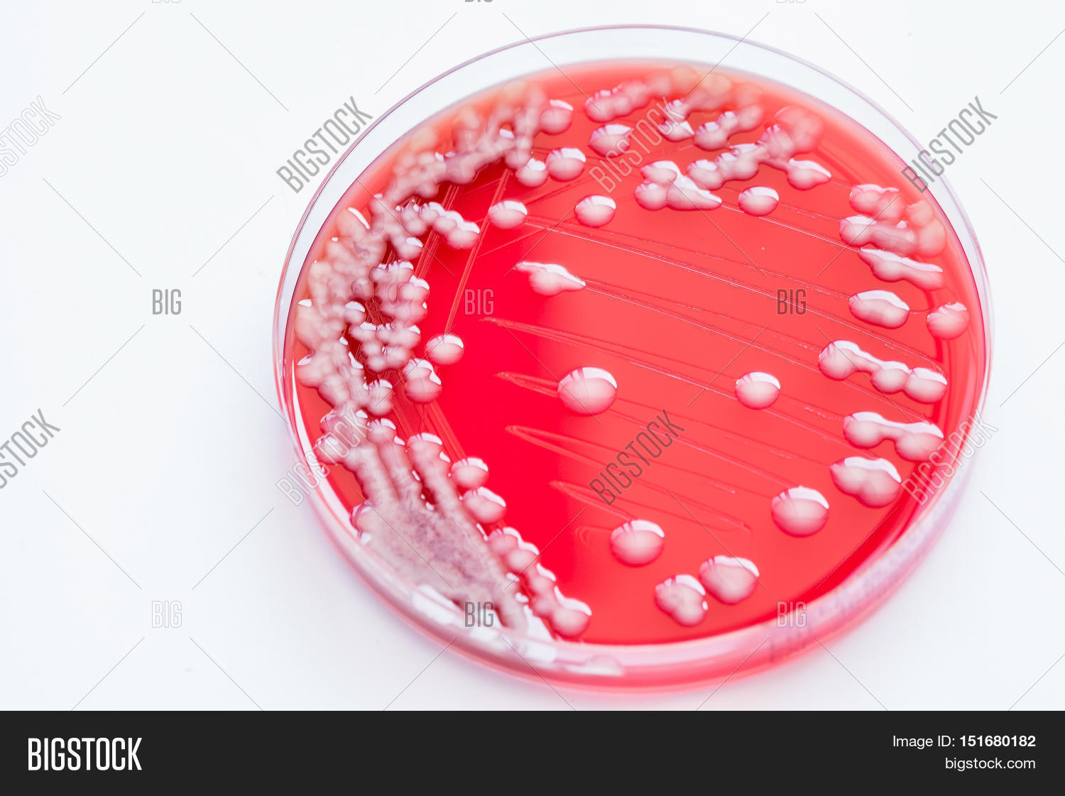 Colonies Bacteria Gram Negative Bacilli/ Gram Negative Cocco Bacilli On ...