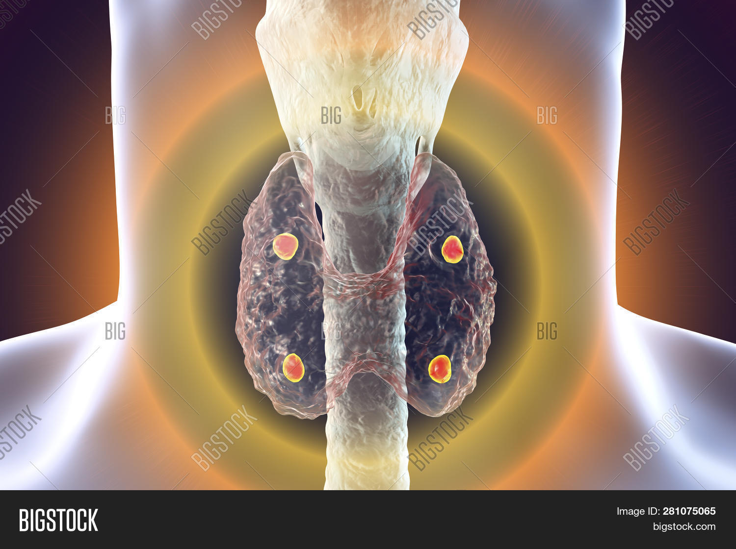 Parathyroid Glands And Thyroid Gland Anatomy, 3d Illustration image ...