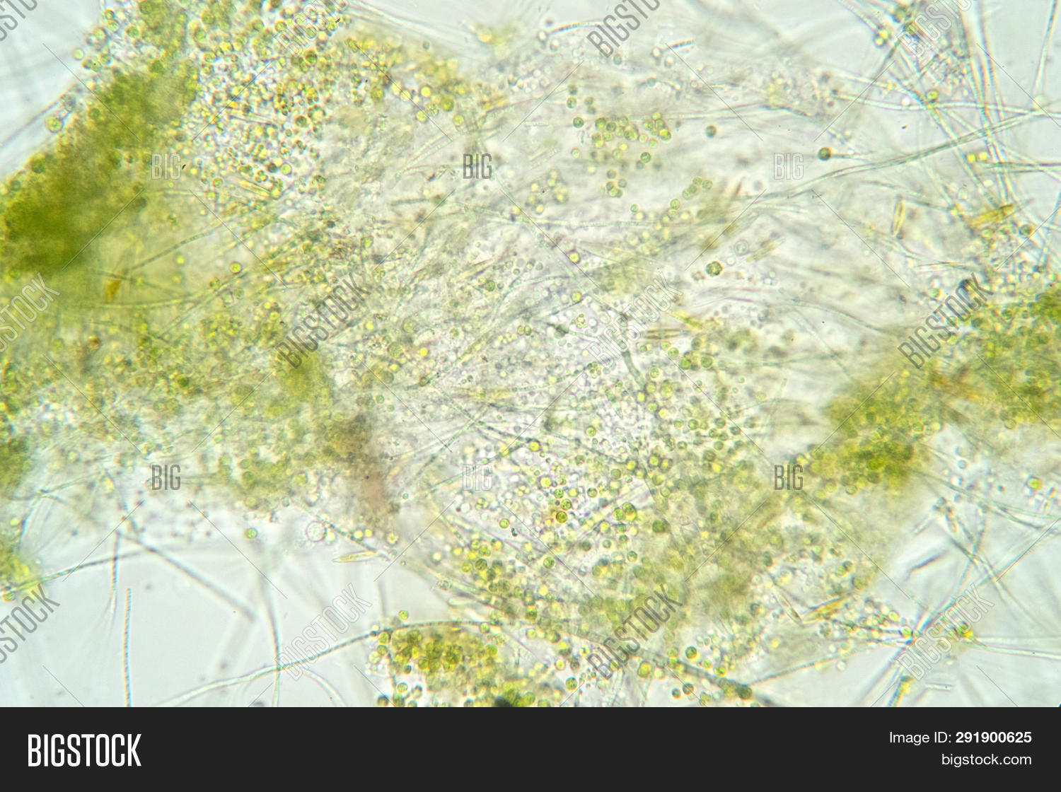 Filamentous Algae Are Single Algae Cells That Form Long Visible Chains ...