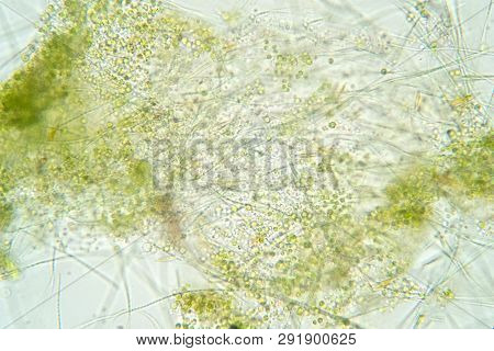 Filamentous Algae Are Single Algae Cells That Form Long Visible Chains ...