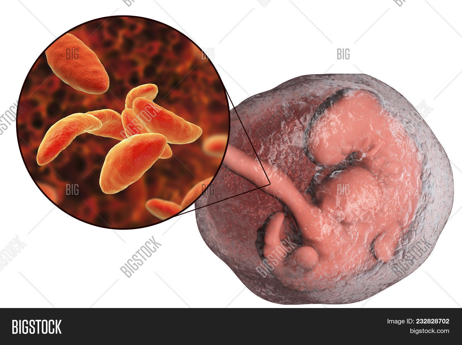 Transplacental Transmission Of Toxoplasma Gondii Parasites To Human ...