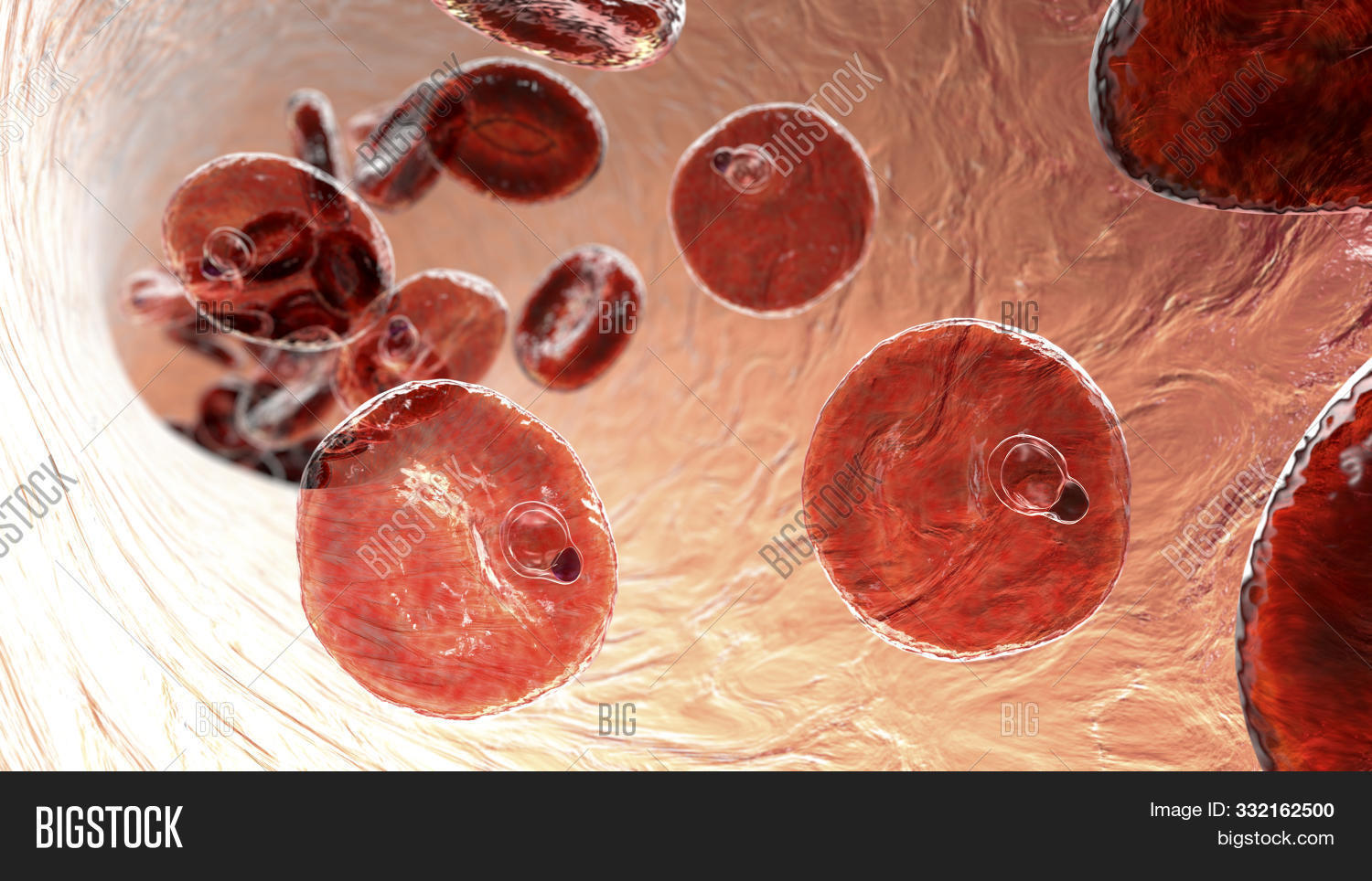 Babesia Parasites Inside Red Blood Cell, The Causative Agent Of ...