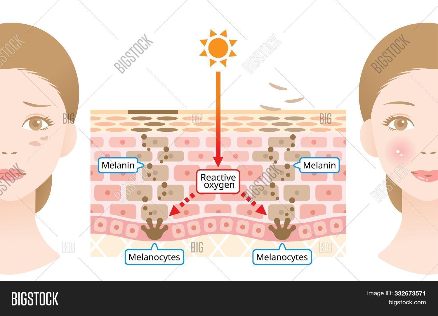 Mechanism Of Skin Cell Turnover Illustration. Melanin And Melanocytes ...