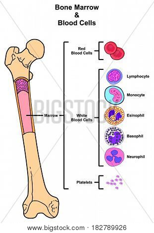 Bone Marrow infographic diagram including femur reproduction of red ...