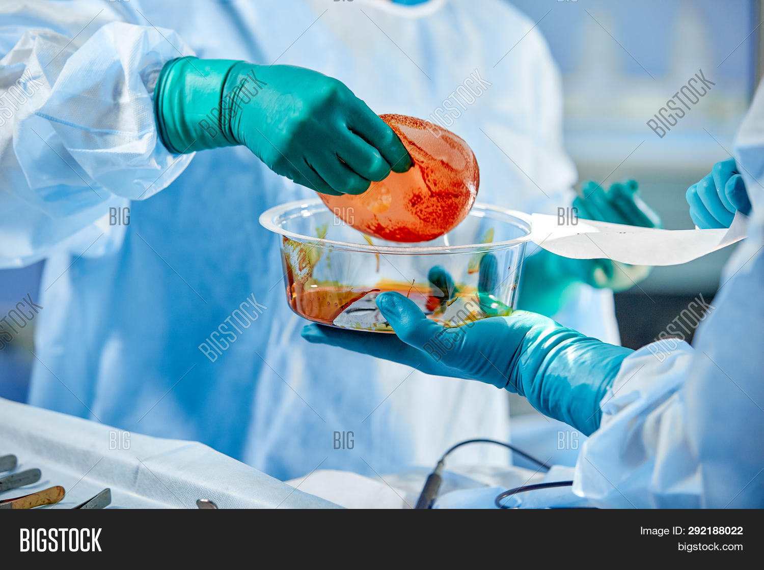 Doctor Holding Silicone Implants For Breast Augmentation In Operating ...