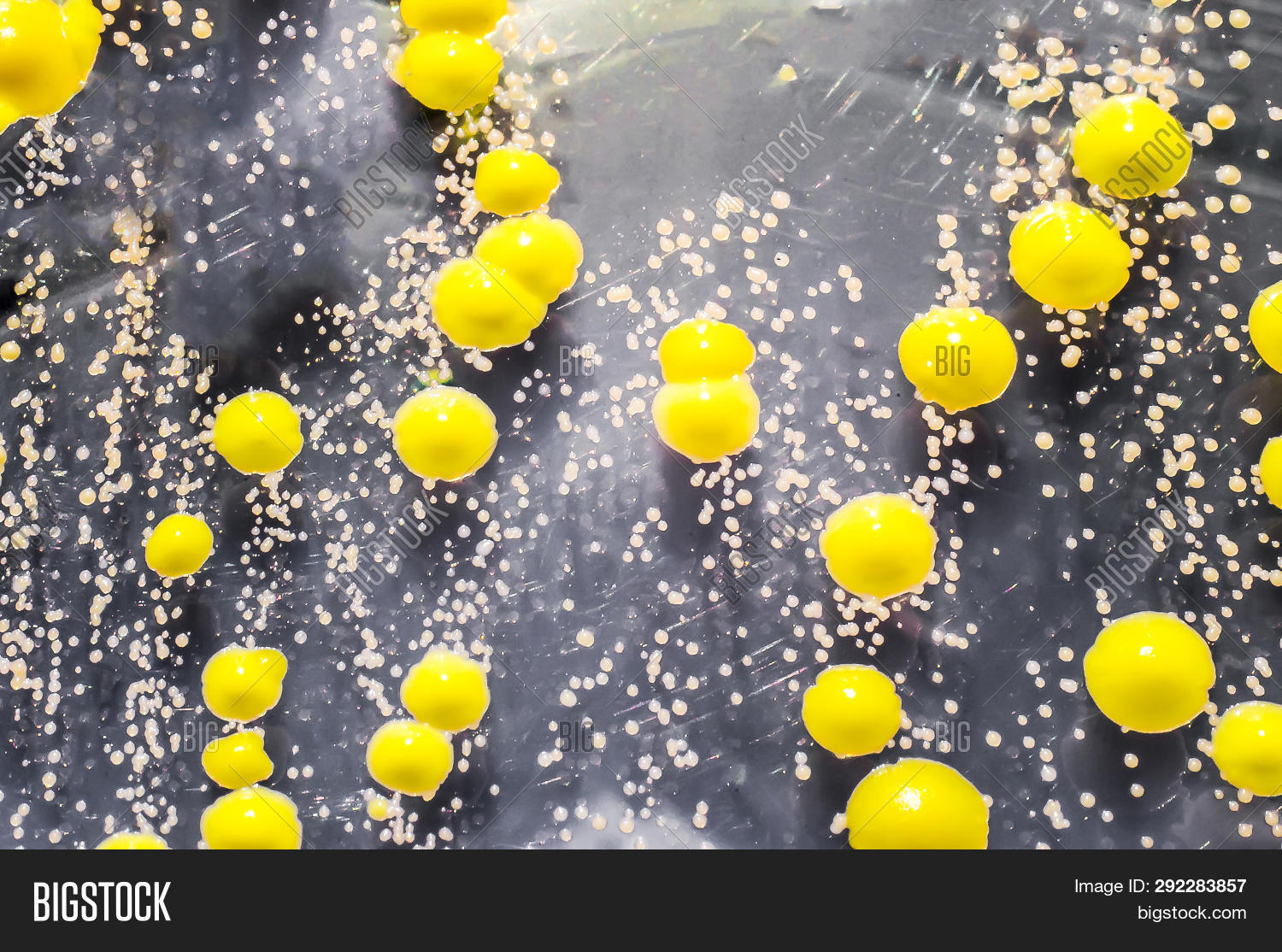 Bacteria Grown From Skin Smear, Colonies Of Micrococcus Luteus And ...