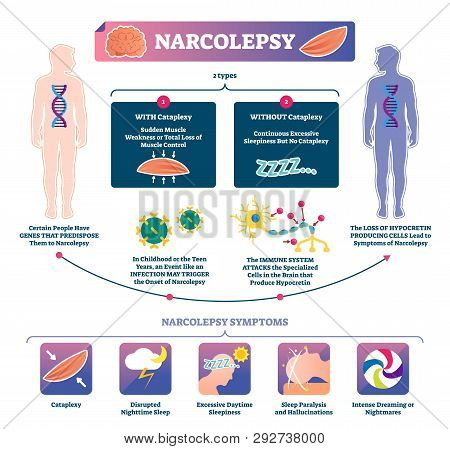 Narcolepsy Vector Illustration. Labeled Muscle Strength Disease ...
