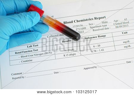 Abnormal renal function test result image & stock photo. 103125017