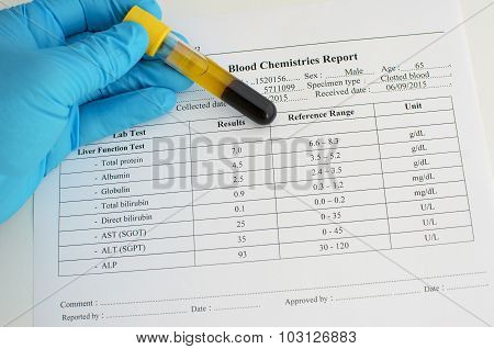 Normal liver function test results image & stock photo. 103126883