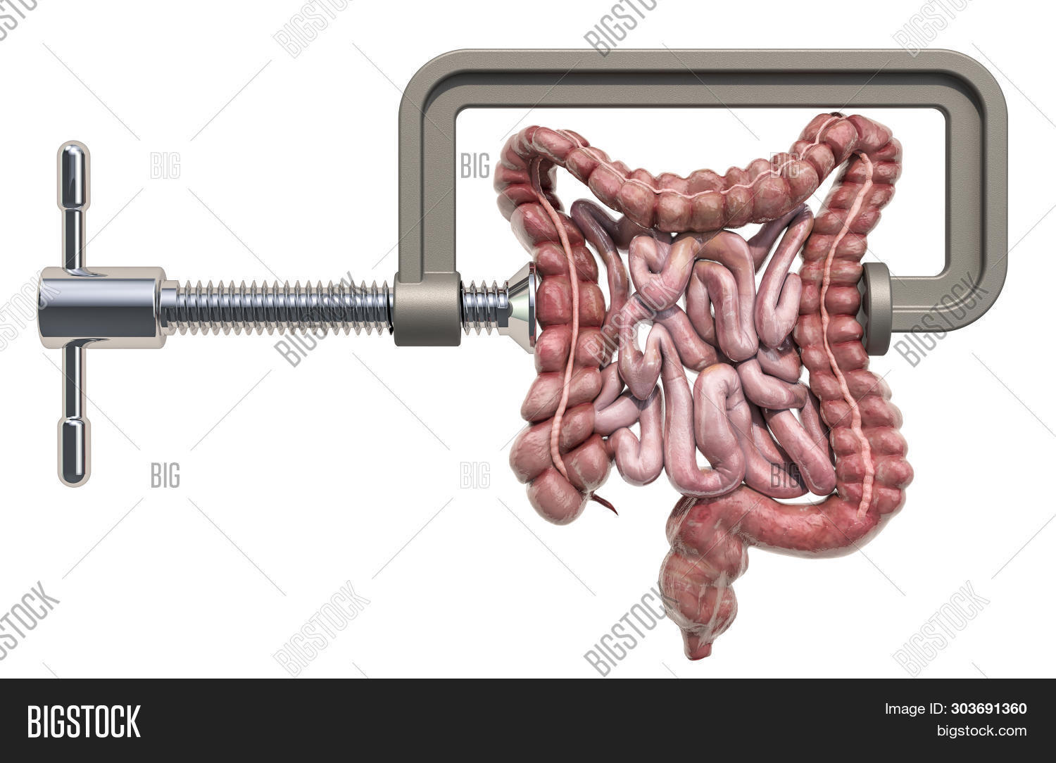 Abdominal Pain Concept. Vise With Human Bowel. 3d Rendering Isolated On ...