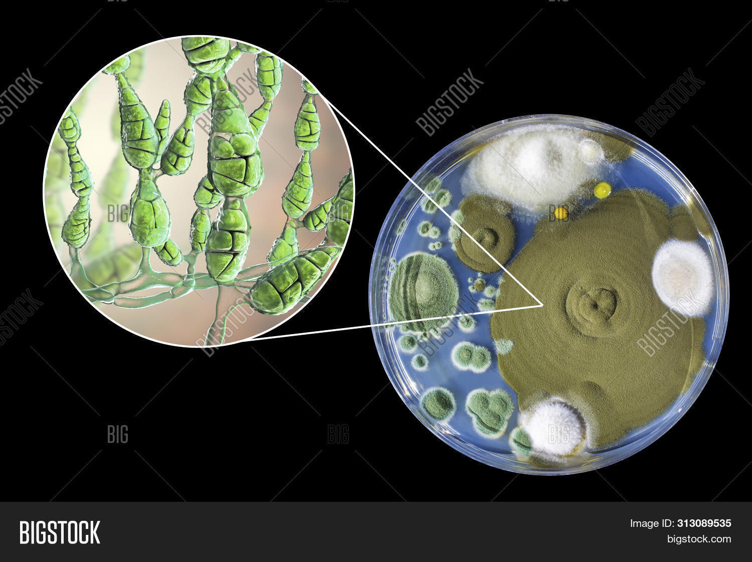 Mold Alternaria Alternata, Allergic Fungus, 3d Illustration And Photo ...