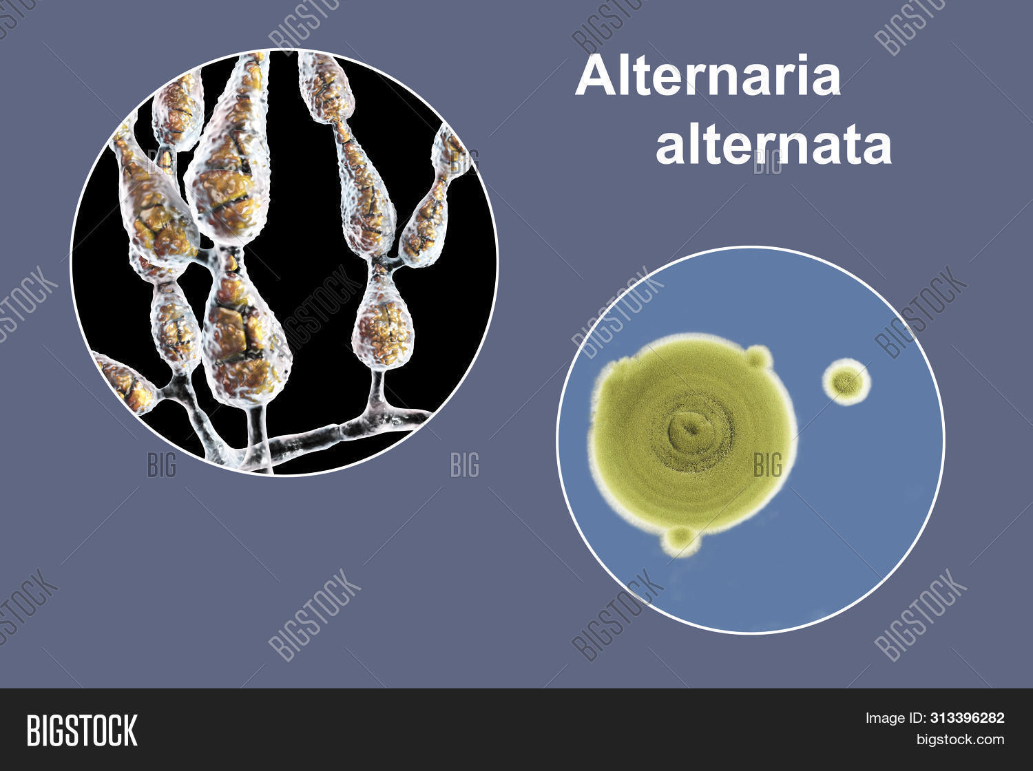 Mold Alternaria Alternata, Allergic Fungus, 3d Illustration And Photo ...