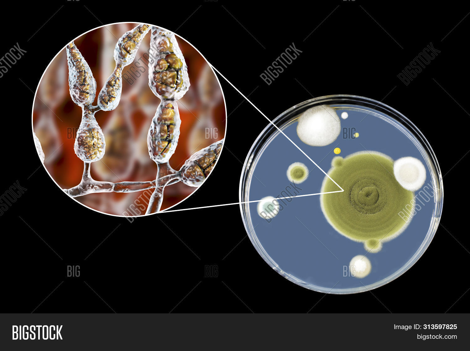 Mold Alternaria Alternata, Allergic Fungus, 3d Illustration And Photo ...