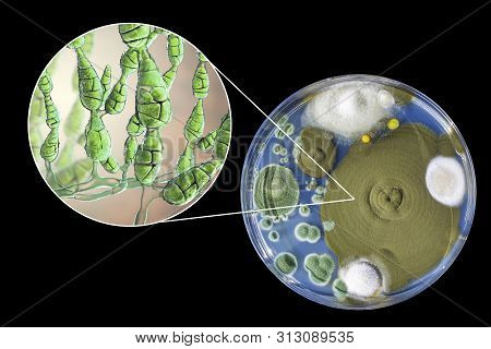 Mold Alternaria Alternata, Allergic Fungus, 3d Illustration And Photo ...