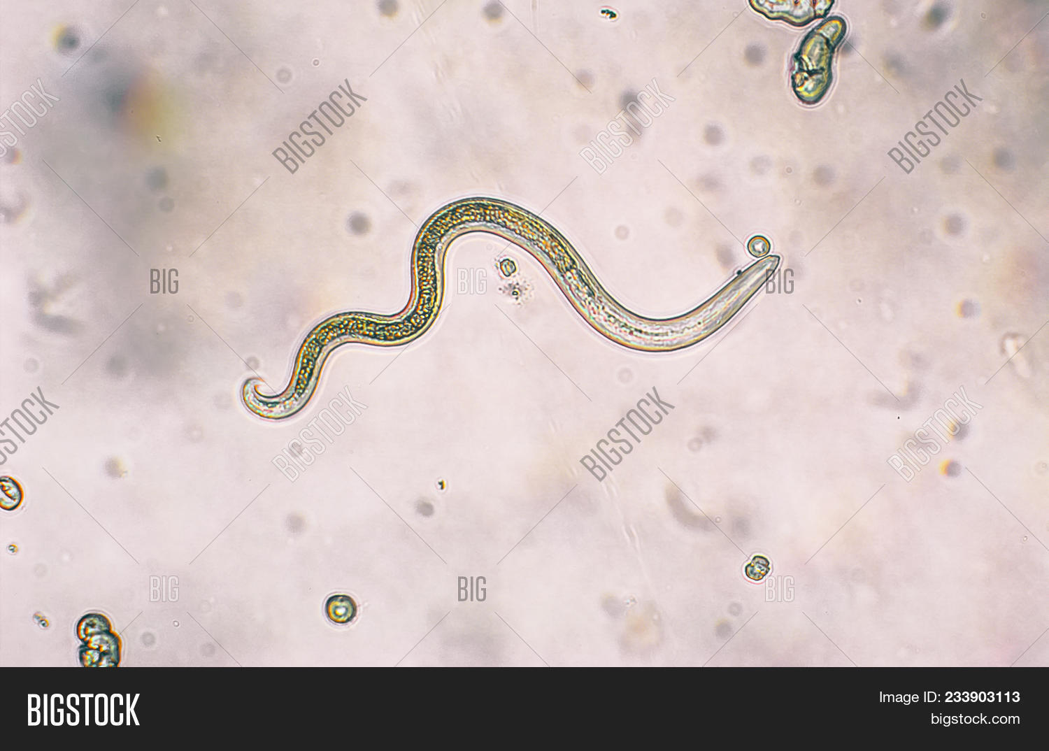 Toxocara Canis Second Stage Larvae Hatch From Eggs In Microscope ...