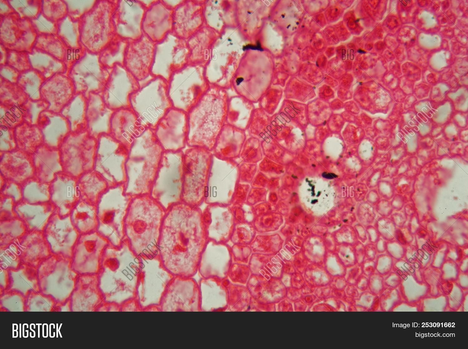 Cross Section Through Cells Of A Root From A Maize Plant Under The ...