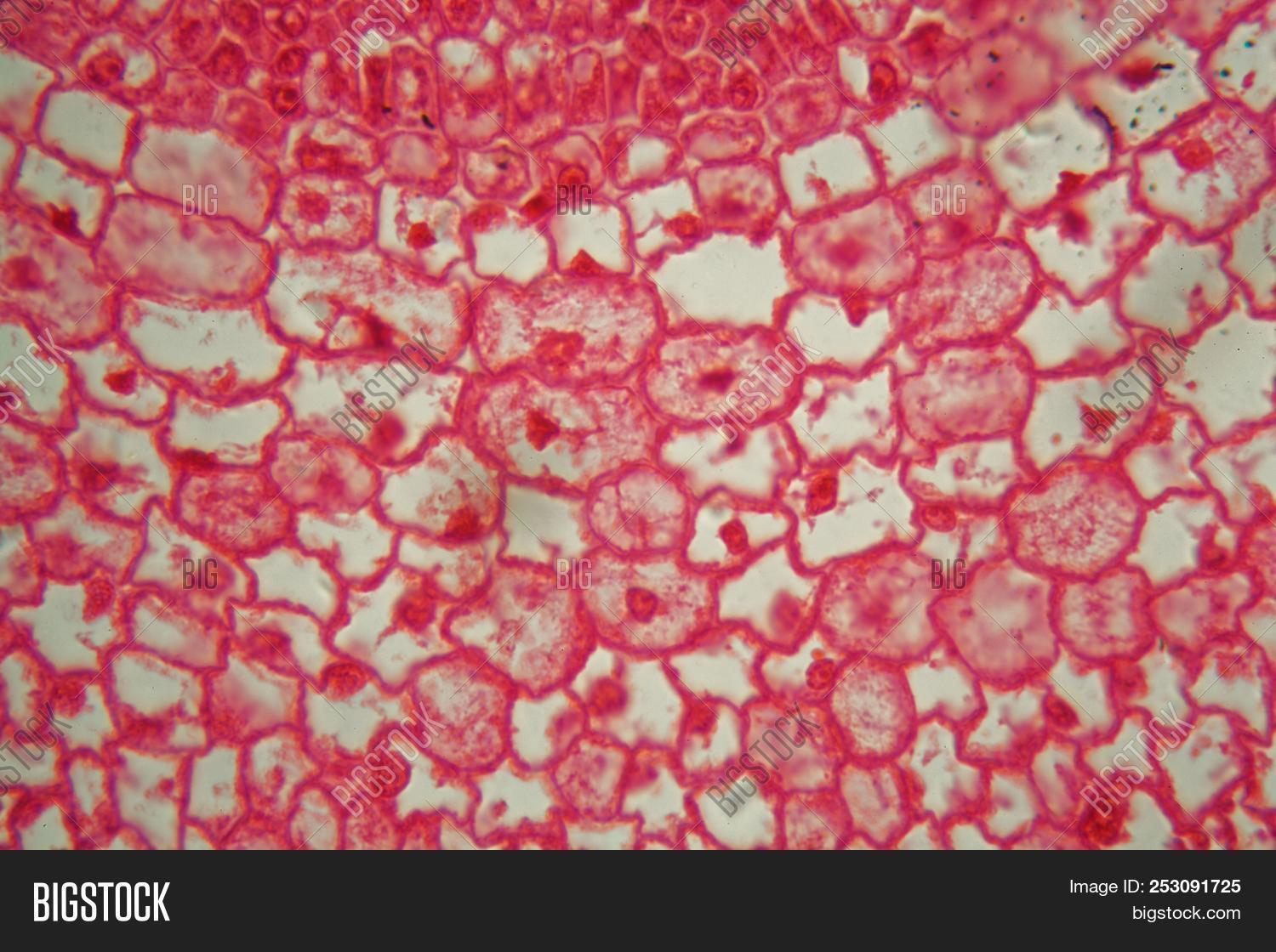 Cross Section Through Cells Of A Root From A Maize Plant Under The ...