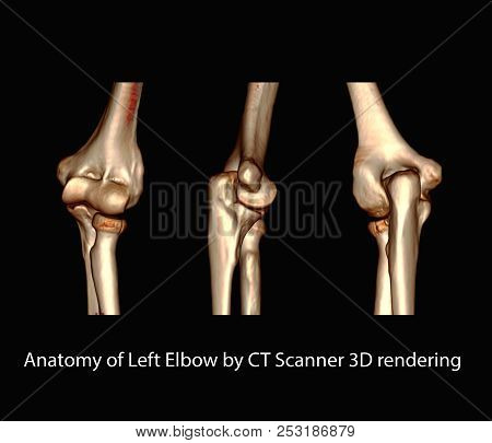 Anatomy Of Left Elbow By Ct Scanner 3d Rendering . Medical Technology ...